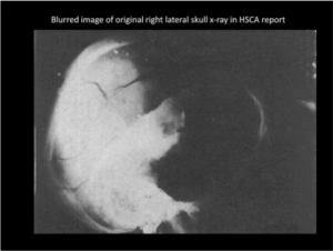 A Review of the JFK Cranial x-Rays and Photographs | Assassination of JFK