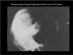 A Review of the JFK Cranial x-Rays and Photographs | Assassination of JFK