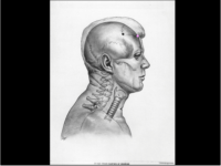 A Review of the JFK Cranial x-Rays and Photographs | Assassination of JFK