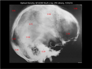 A Review of the JFK Cranial x-Rays and Photographs | Assassination of JFK